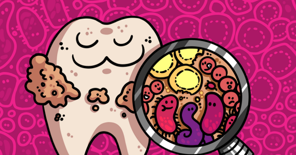 Putting dental calculus under the microscope - Leiden University