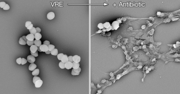Nathaniel Martin in Scientias over veelbelovende oplossing tegen ...