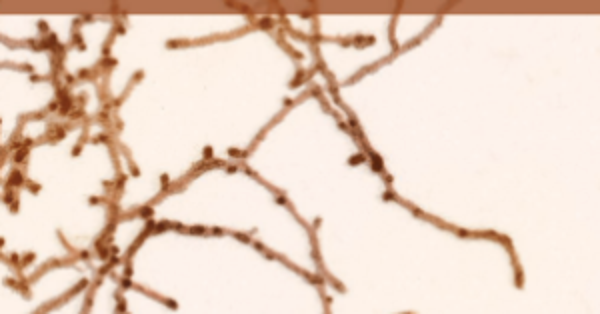 Molecular characterization of copper-dependent enzymes involved in ...