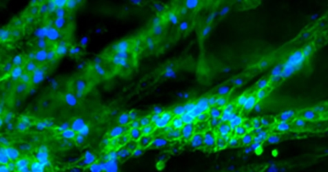 Cancer Drug Target Discovery - Leiden University