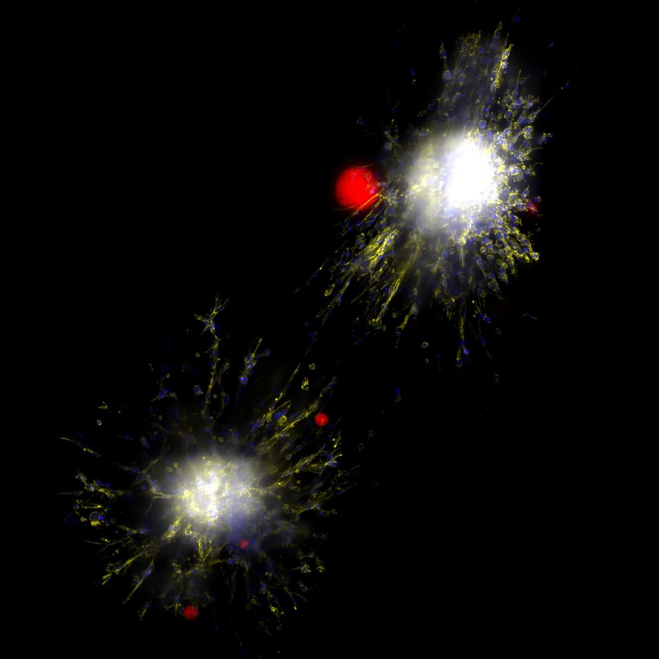 Physics in the picture: cancer cells as an explosion of fireworks ...