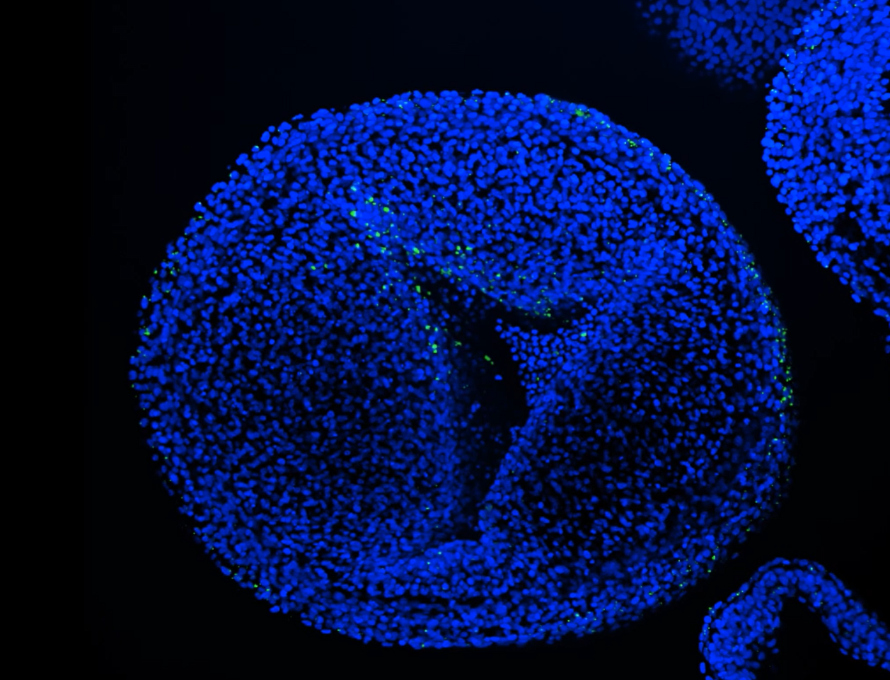 Nano-plastics Cause Heart, Eye, Nervous System Malformations | Mirage News