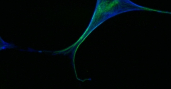 Functional fluorescent materials and migration dynamics of neural ...