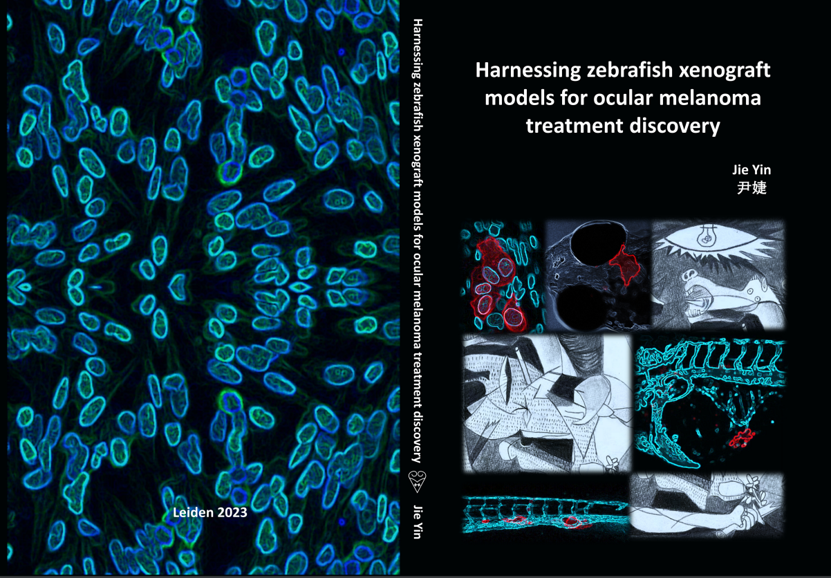 Harnessing zebrafish xenograft models for ocular melanoma treatment ...