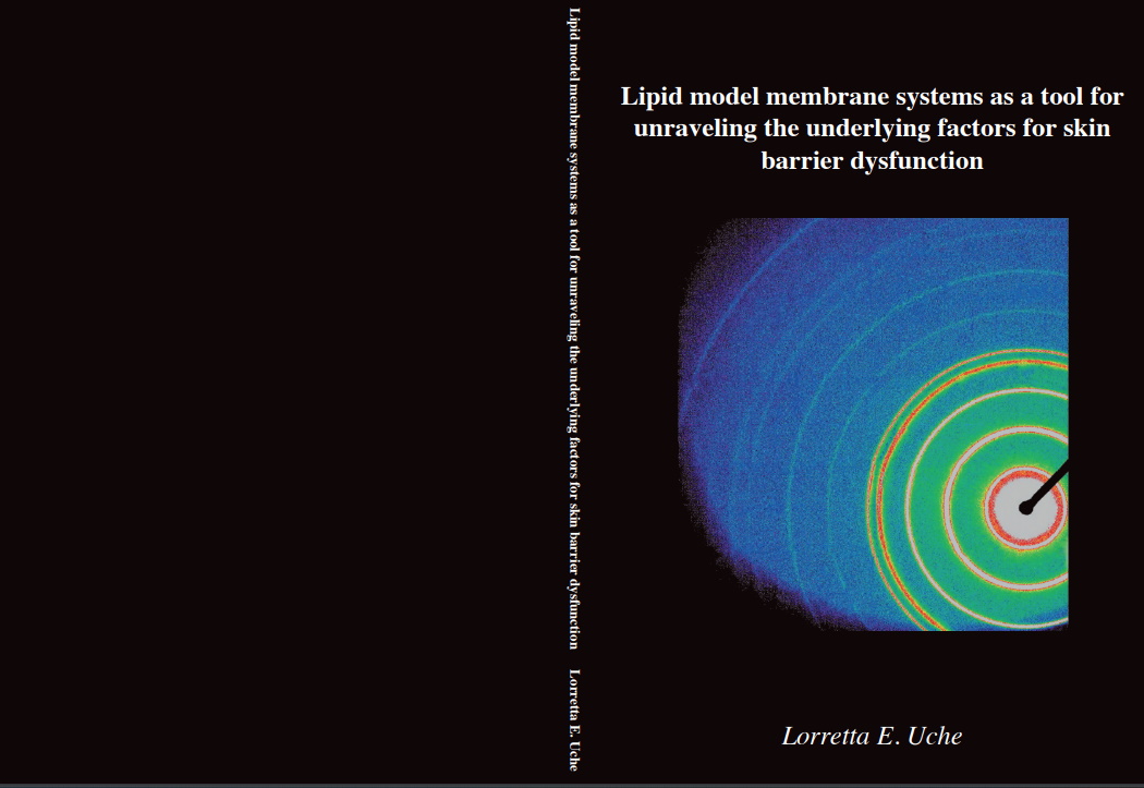 Lipid model membrane systems as a tool for unraveling the underlying ...