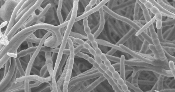 Bacteria under stress can live without cell wall - Leiden University